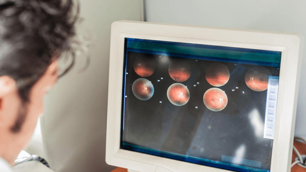 Understanding Optomap Retinal Exam: a Window to Your Eye Health